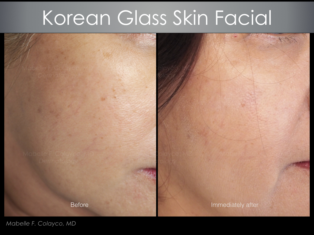 korean glass skin 1 – Dermalogique