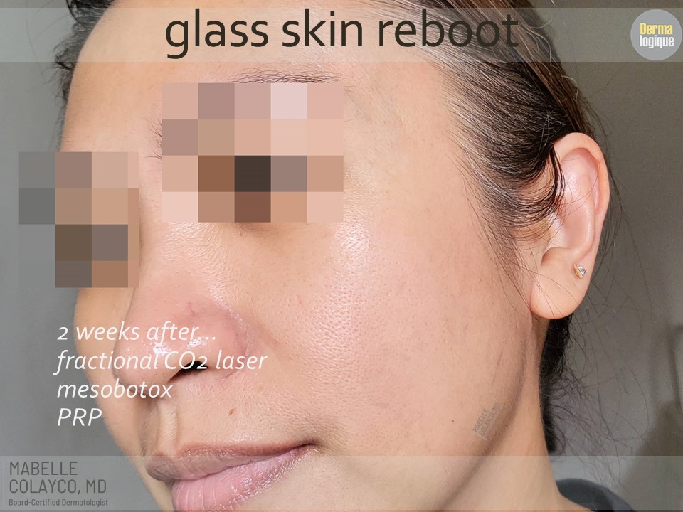 Give your skin an ultraboost with glass skin reboot – Dermalogique